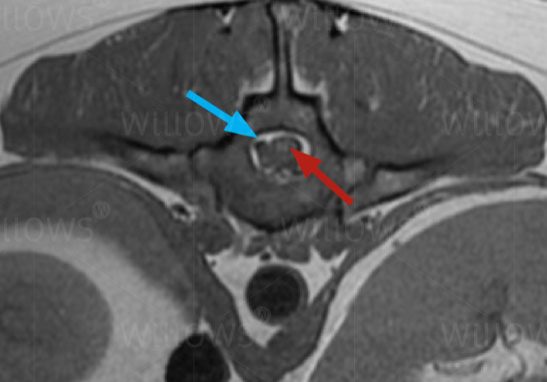 What is an MRI Scan? | Willows UK | West Midlands
