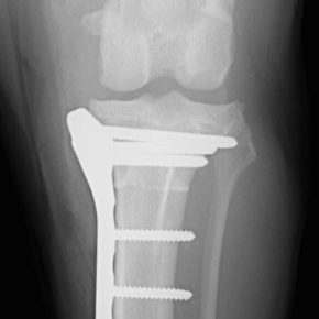TPLO Surgery | Willows UK | West Midlands | Willows